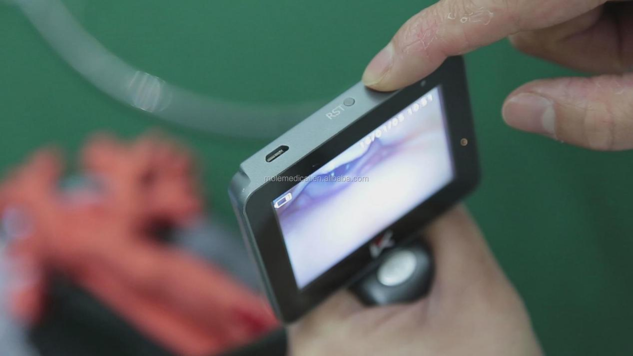 Optimizing Airway Management: Types of Video Laryngoscopes